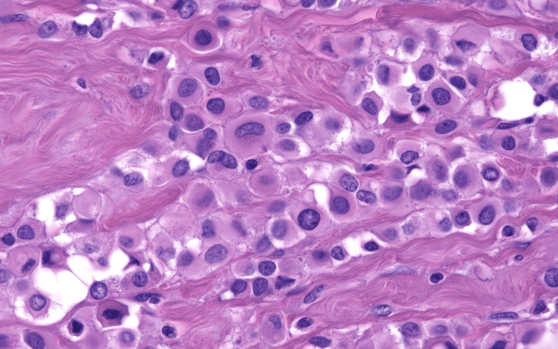 Laboratoire d'histologie - Excilone Services